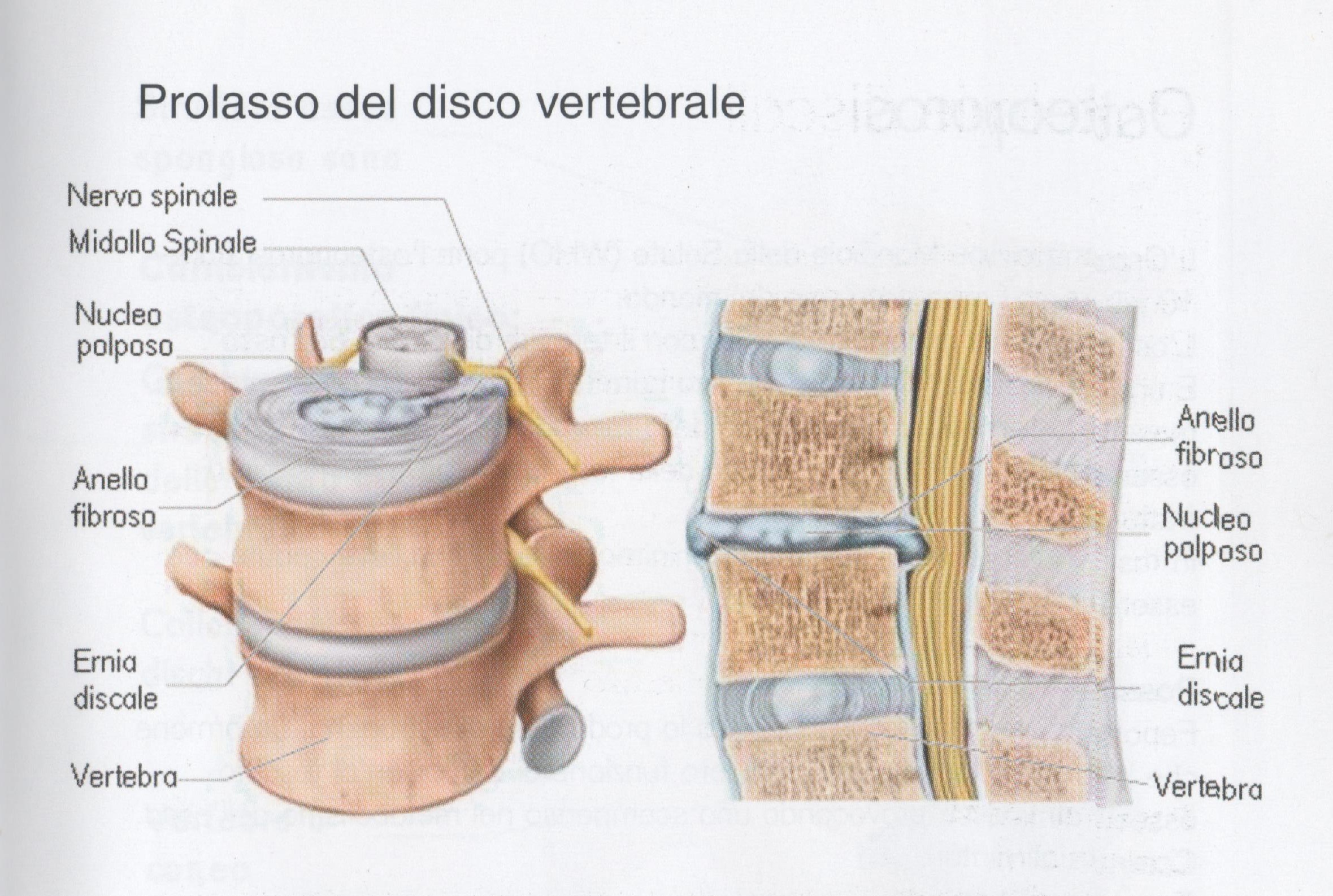 Patologie discali - Medical Farma ortopedia Bergamo