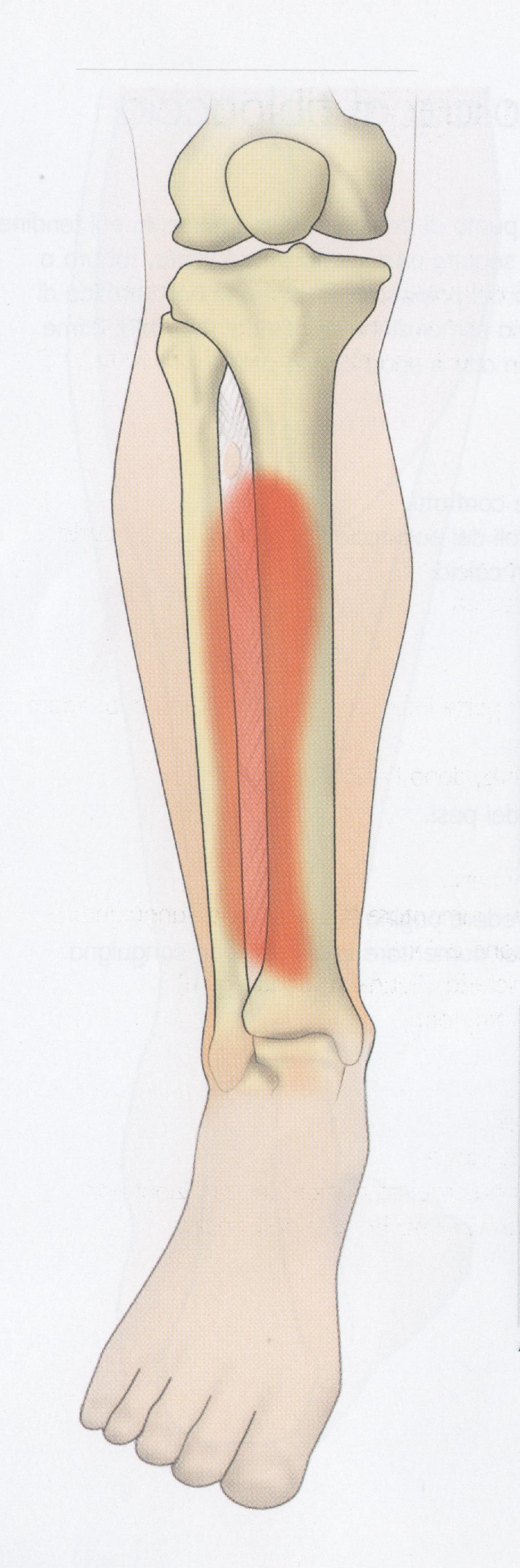 Sindrome della loggia del tibiale anteriore - Medical Farma ortopedia ...