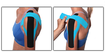 Nastro taping scapola, spalla e braccio - Medical Farma ortopedia Bergamo